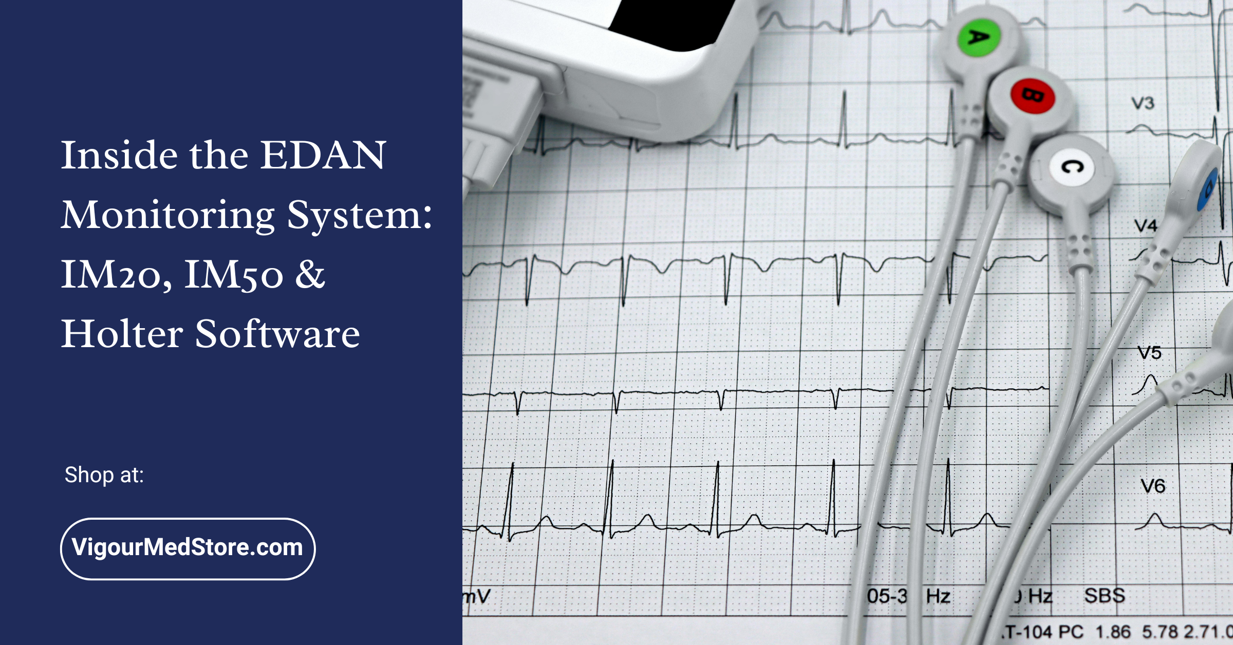 EDAN IM20 vs IM50 + Holter Software Guide