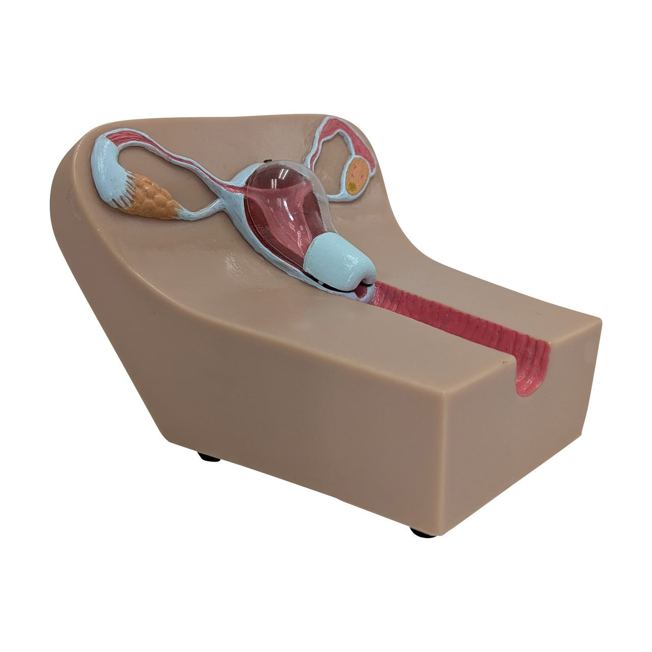 Anatomy Lab A-104452 IUD Insertion Model I, 1/ea – Adult Female Uterus ...